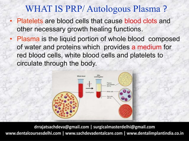 Prp Skin Rejuvenation | Platelet Rich Plasma | PRP and Vampire Facial ...