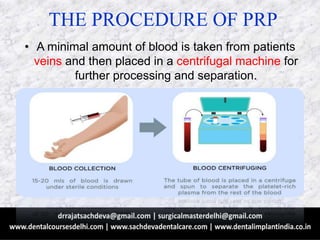 Prp Skin Rejuvenation | Platelet Rich Plasma | PRP and Vampire Facial ...