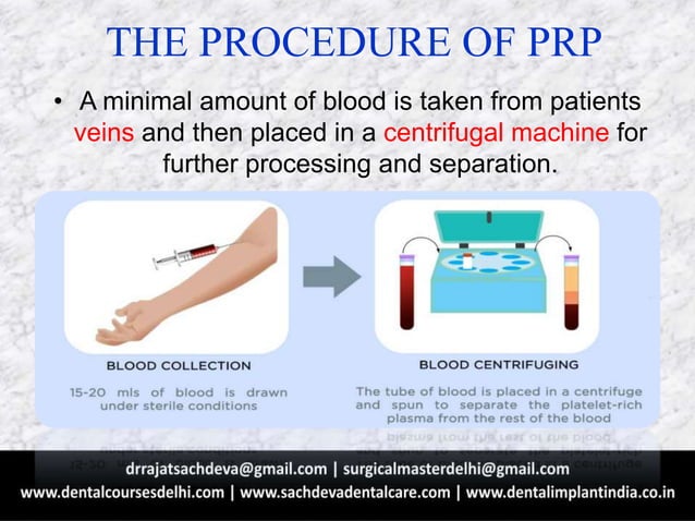 Prp Skin Rejuvenation | Platelet Rich Plasma | PRP and Vampire Facial ...
