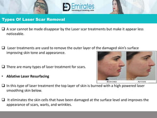 skin laser treatment | PPTX