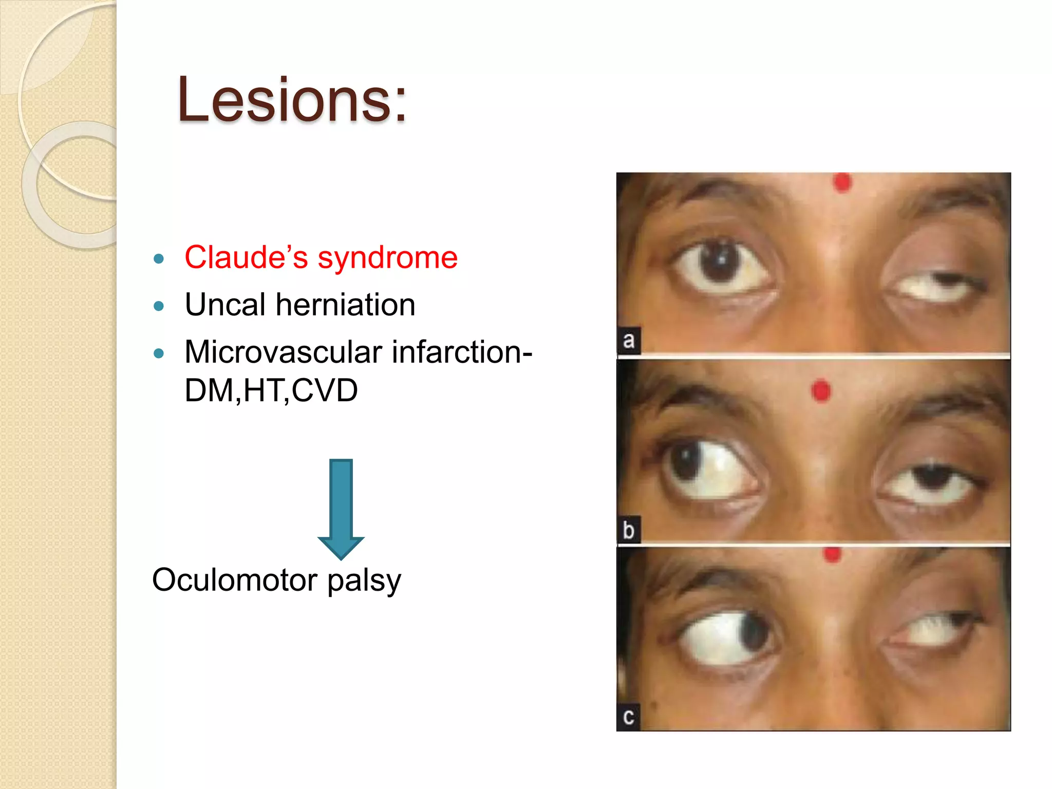 anatomy of cranial nerves and its medicolegal importance | PPTX