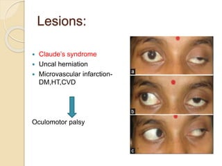 anatomy of cranial nerves and its medicolegal importance | PPTX