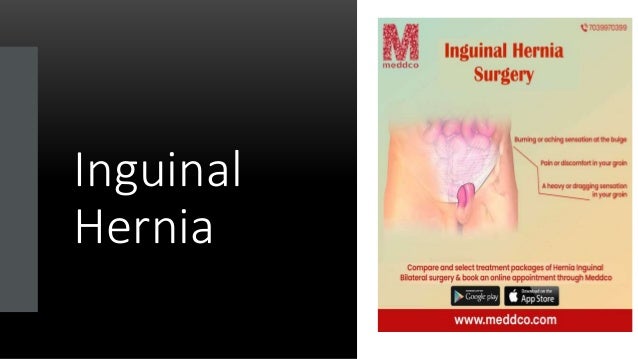 Inguinal Hernia Surgery | PPTX