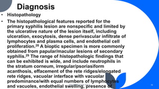 Syphilis | PPT