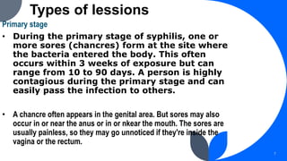 Syphilis | PPT