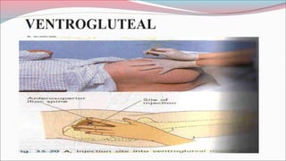 INTRAMUSCULAR INJECTION | PPT