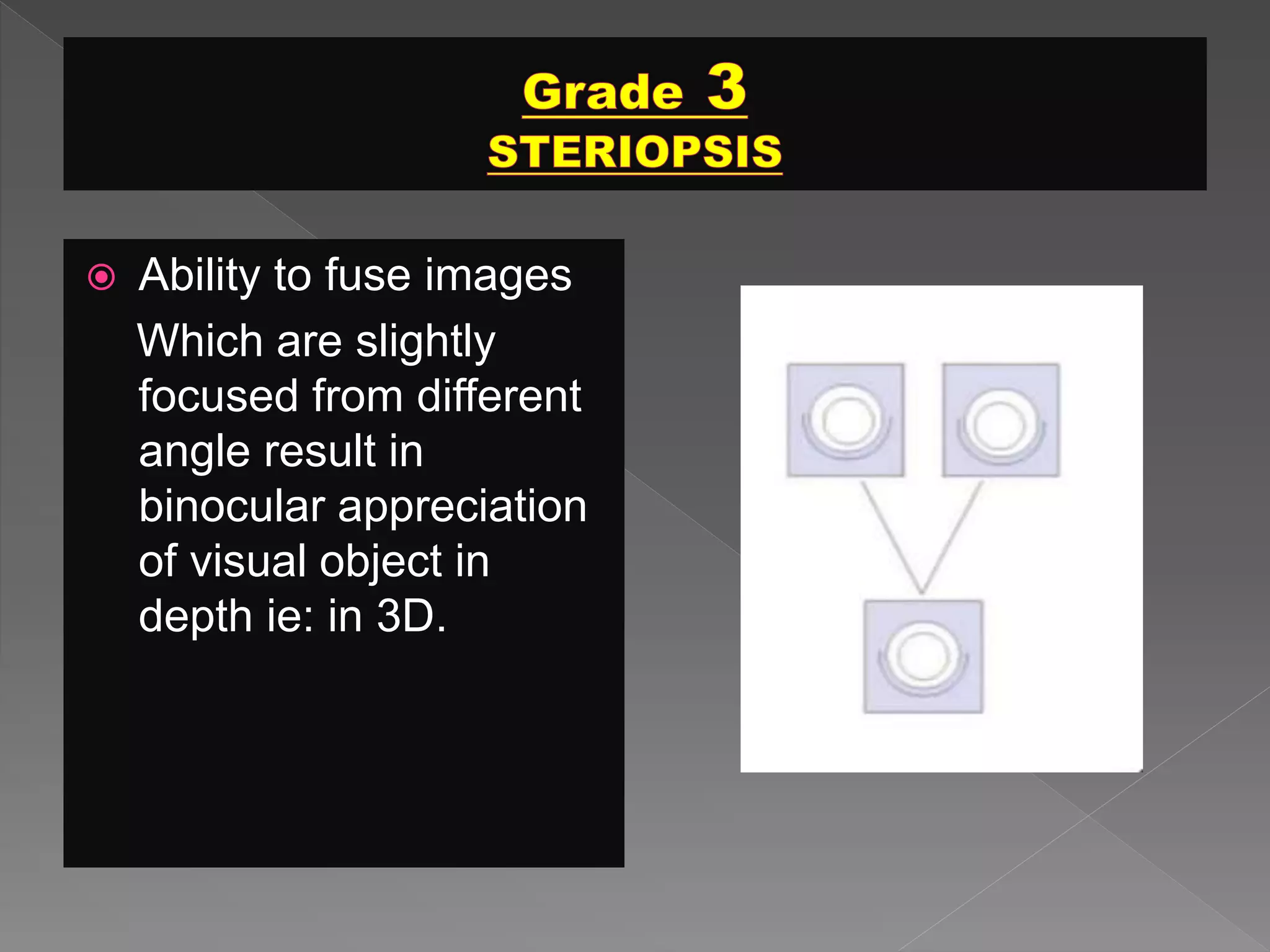 Simultaneous Macular Perception -Nayana | PPTX