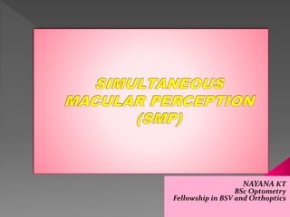 Simultaneous Macular Perception -Nayana | PPTX