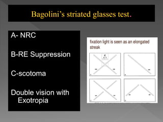 Simultaneous Macular Perception -Nayana | PPTX
