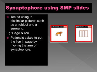 Simultaneous Macular Perception -Nayana | PPTX