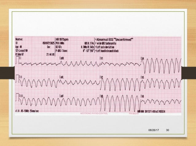 Crash Cart Medication | PPT