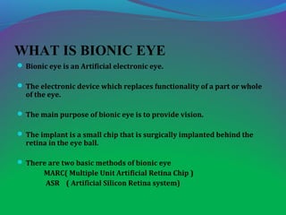 BIONIC EYE | PPT