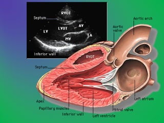 ECHOCARDIOGRAM | PPT
