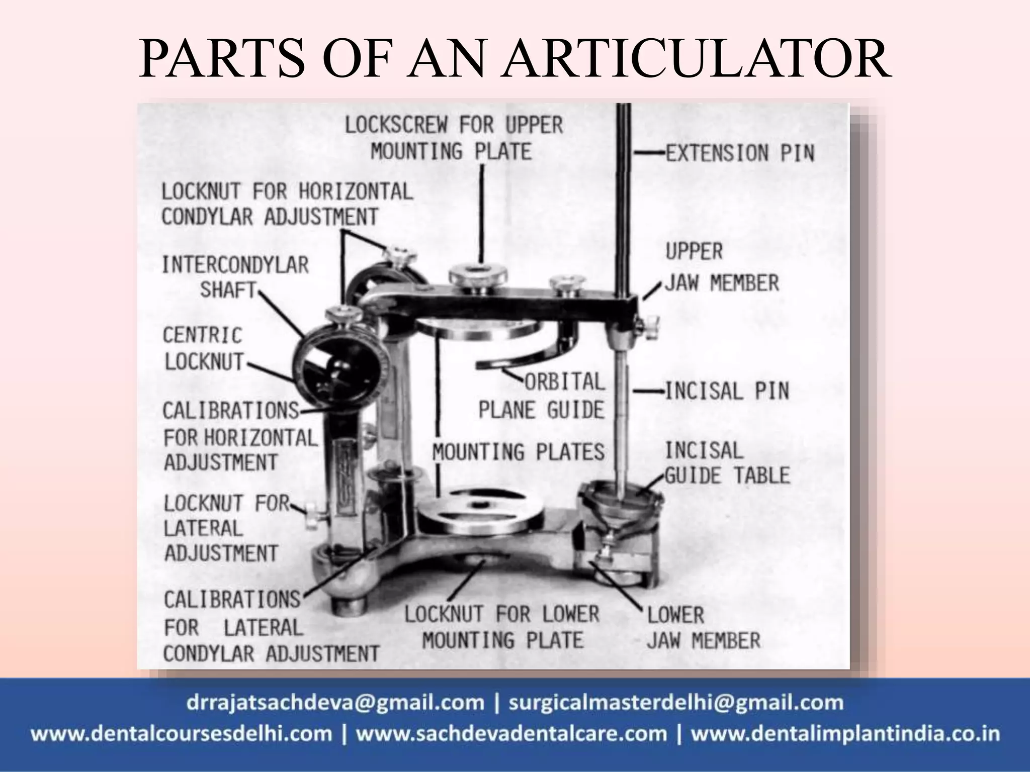 THE NEED OF ARTICULATORS IN DENTAL RESTORATION PROCESS | Fully ...