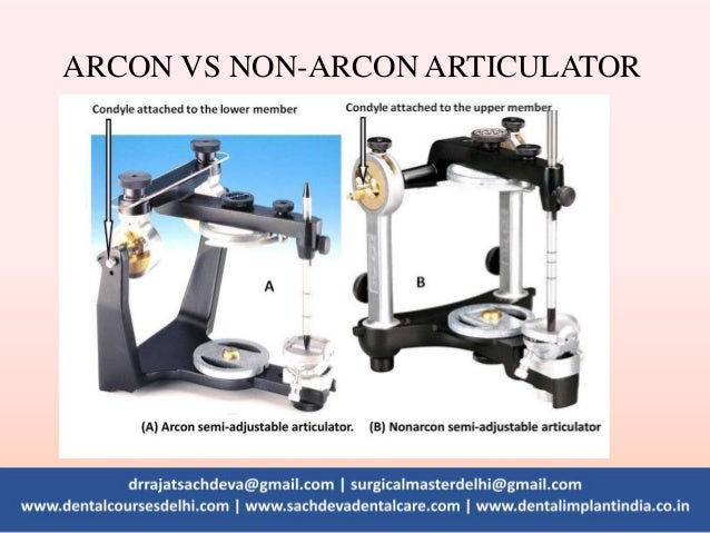 THE NEED OF ARTICULATORS IN DENTAL RESTORATION PROCESS | Fully Adjust…