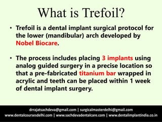 Trefoil Dental Implant from Nobel biocare | Trefoil: a new solution for ...