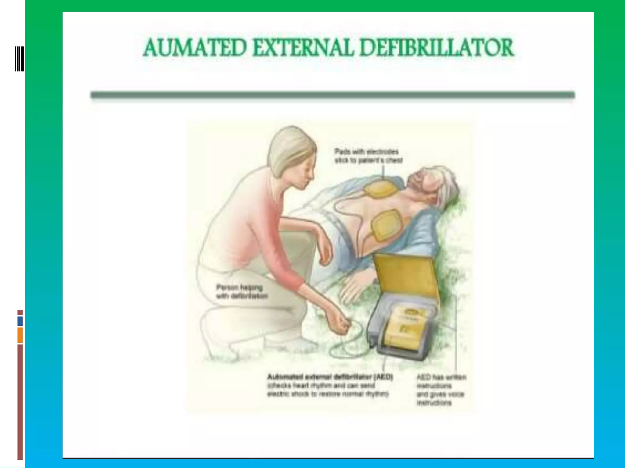 AUTOMATED EXTERNAL DEFIBRILLATOR | PPTX