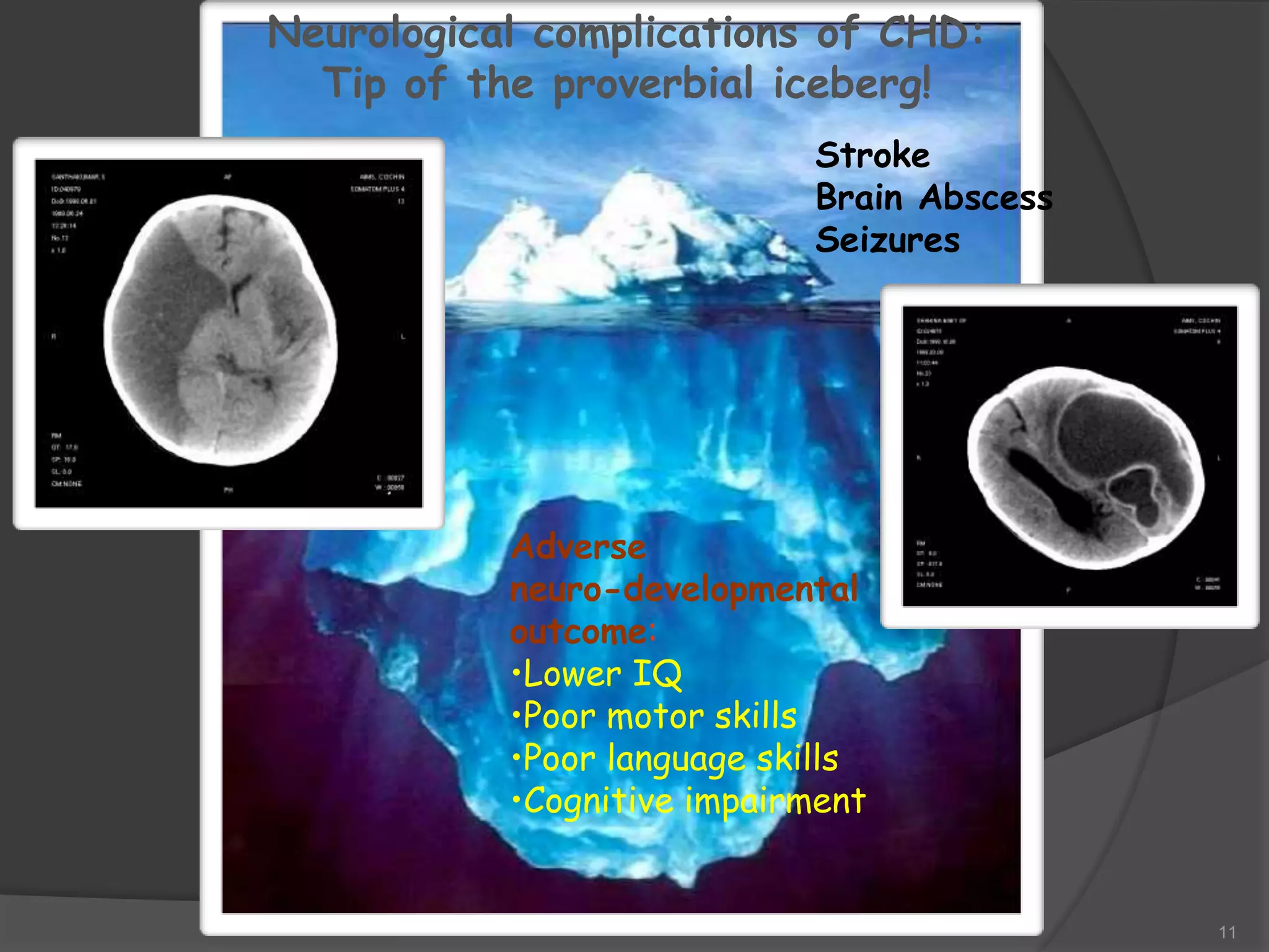 WHEN TO REFER TO A PEDIATRIC CARDIOLOGIST | PPTX