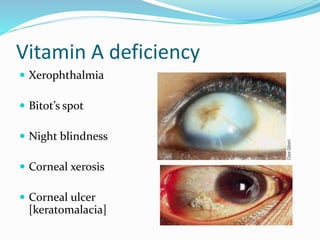 anatomy of eye and its medicolegal importance | PPTX