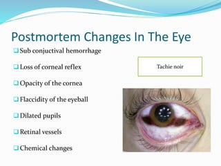 anatomy of eye and its medicolegal importance | PPTX