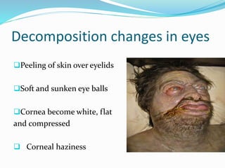 anatomy of eye and its medicolegal importance | PPTX