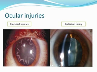 anatomy of eye and its medicolegal importance | PPTX
