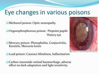 anatomy of eye and its medicolegal importance | PPTX