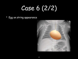 NAMED IMAGING SIGNS IN PEDIATRIC CARDIOLOGY | PPTX