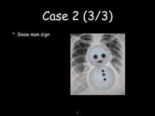 NAMED IMAGING SIGNS IN PEDIATRIC CARDIOLOGY | PPT