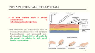 ADVANCED Insulin delivery methods: Past, present and future | PPTX