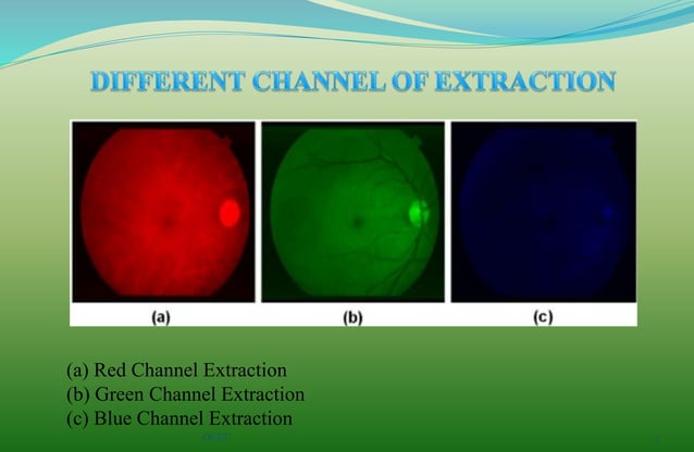 AUTOMATIC SEGMENTATION OF BLOOD VESSELS DETECTION IN RETINAL IMAGES BY USING GABOR FILTER | PPTX