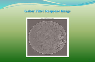 AUTOMATIC SEGMENTATION OF BLOOD VESSELS DETECTION IN RETINAL IMAGES BY USING GABOR FILTER | PPT