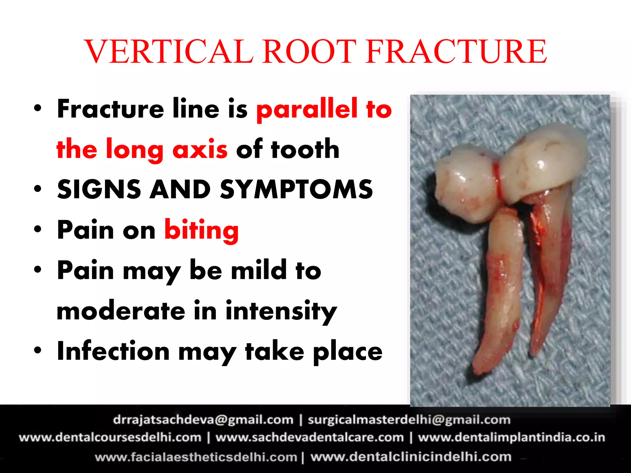 Tooth Injuries| Tooth Trauma| Treatment of Tooth Trauma | PPTX