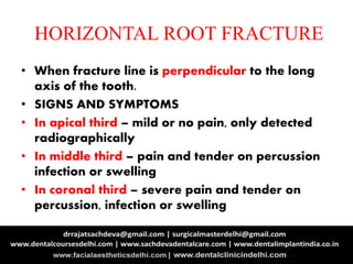 Tooth Injuries| Tooth Trauma| Treatment of Tooth Trauma | PPTX