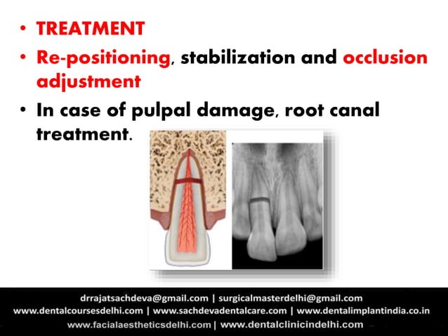 Tooth Injuries| Tooth Trauma| Treatment of Tooth Trauma | PPTX