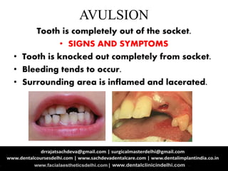 Tooth Injuries| Tooth Trauma| Treatment of Tooth Trauma | PPTX