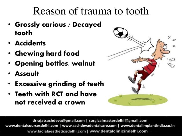 Tooth Injuries| Tooth Trauma| Treatment of Tooth Trauma