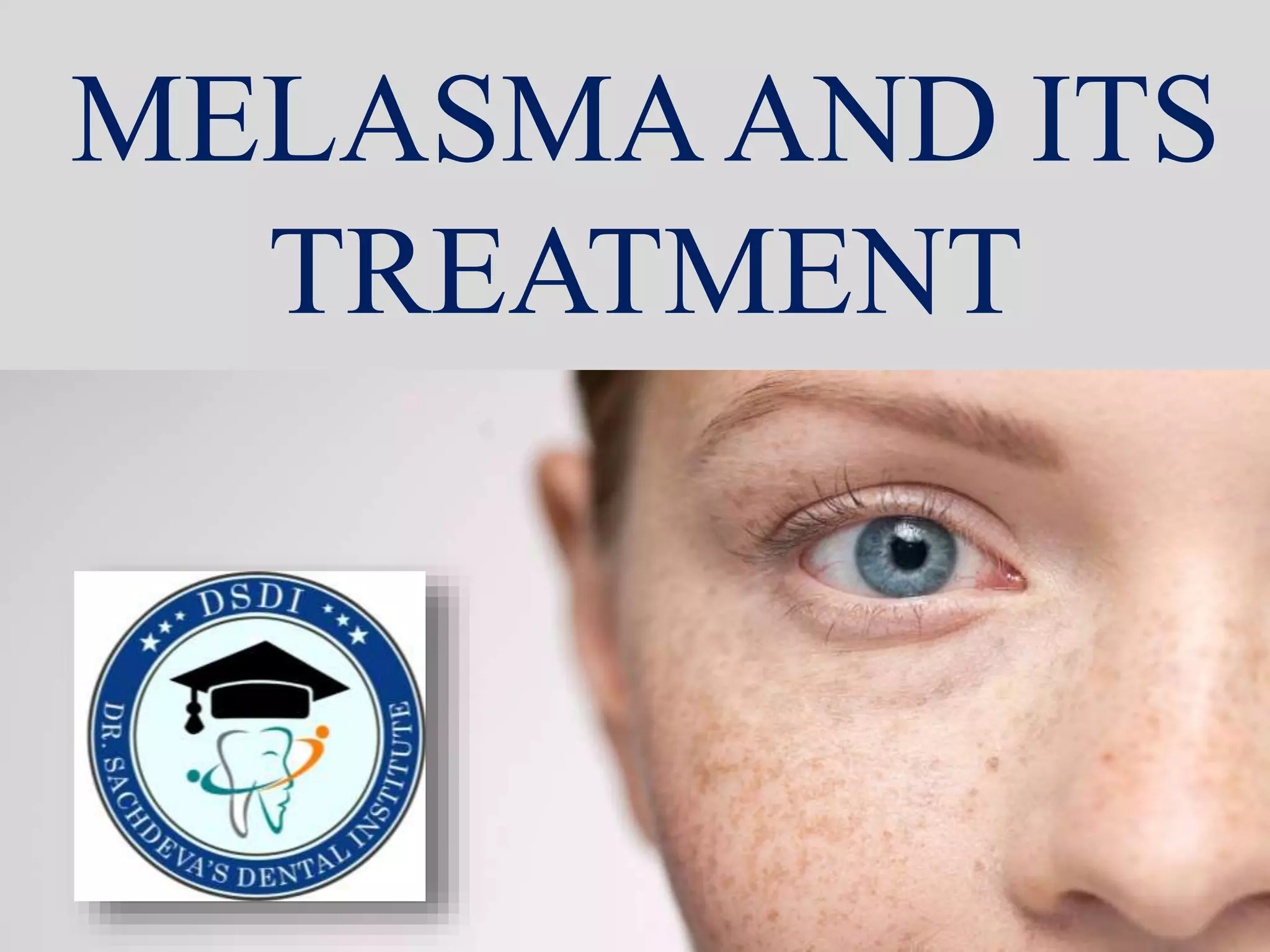 Melasma| Melasma and its Treatment| Facial Pigmentation| Post-Pregnancy ...