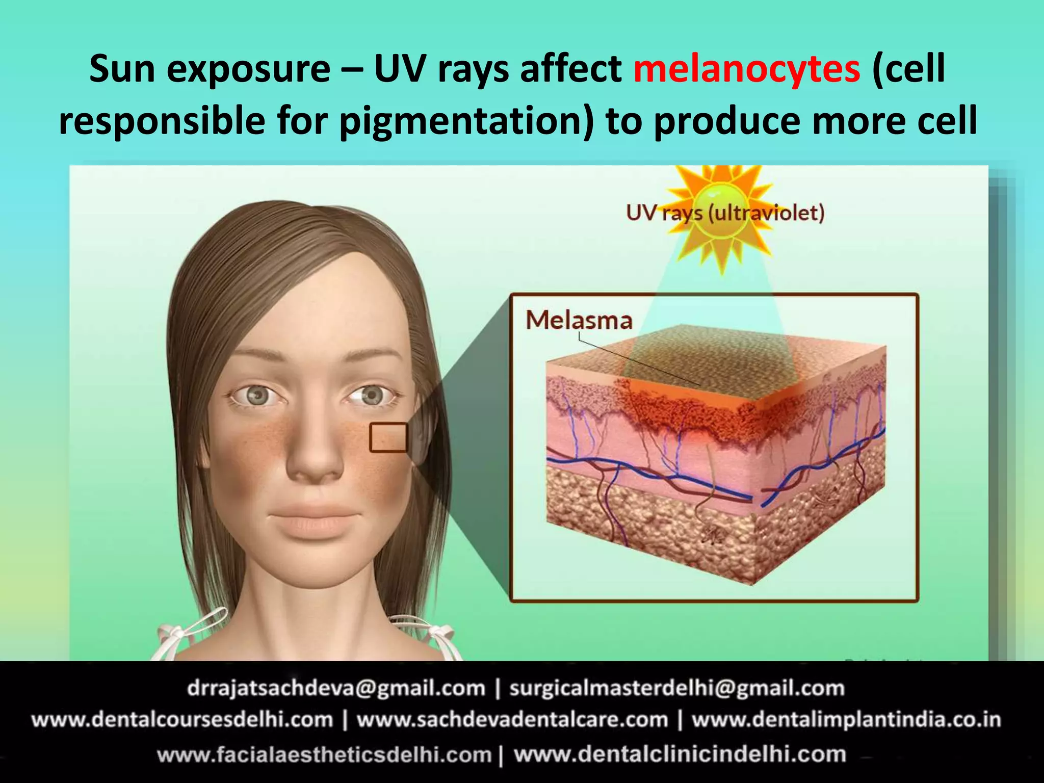 Melasma| Melasma and its Treatment| Facial Pigmentation| Post-Pregnancy ...