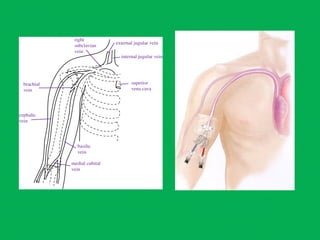 MOBILE IMAGING INTERFACE UNIT (C ARM) | PPT