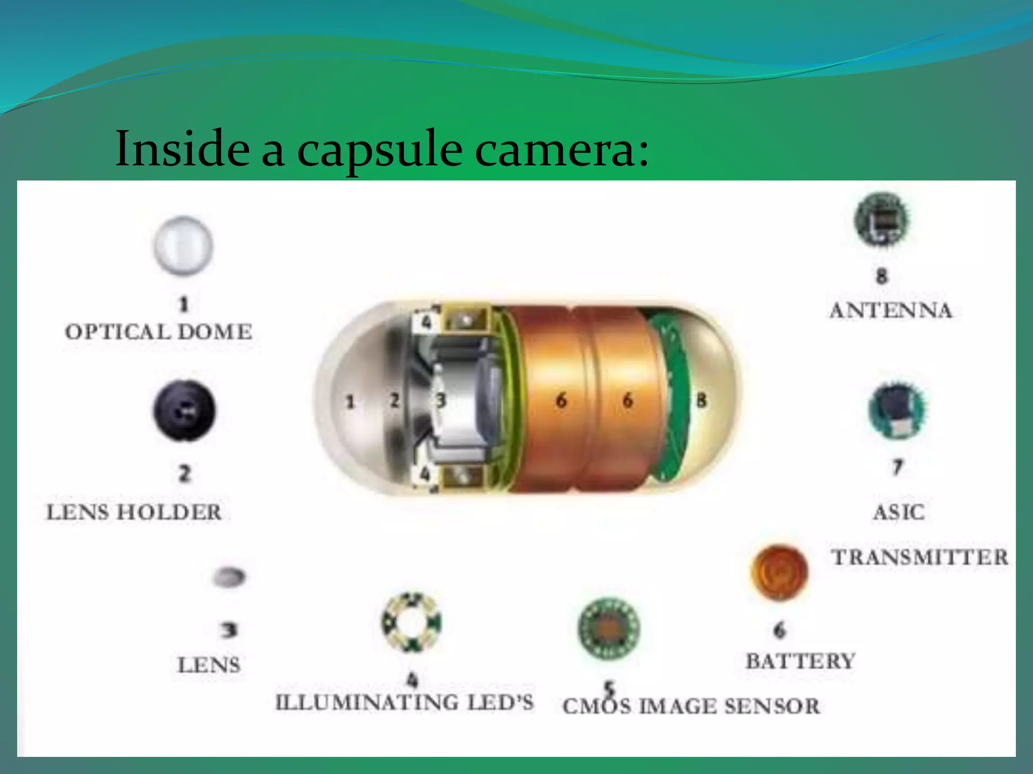 CAPSULE ENDOSCOPY | PPTX | Digestive Disorders | Diseases and Conditions