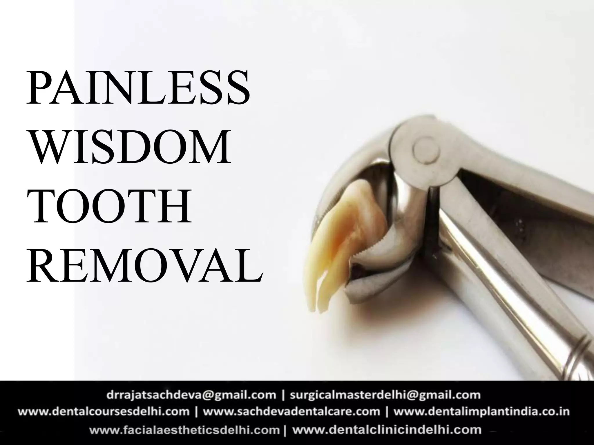 Painless Wisdom Tooth Removal| Impaction of Third Molar| Piezo and ...