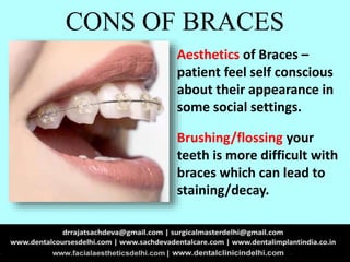 Clip On Orthodontic Dental Clinic- Braces Invisalign Studio, 52% OFF