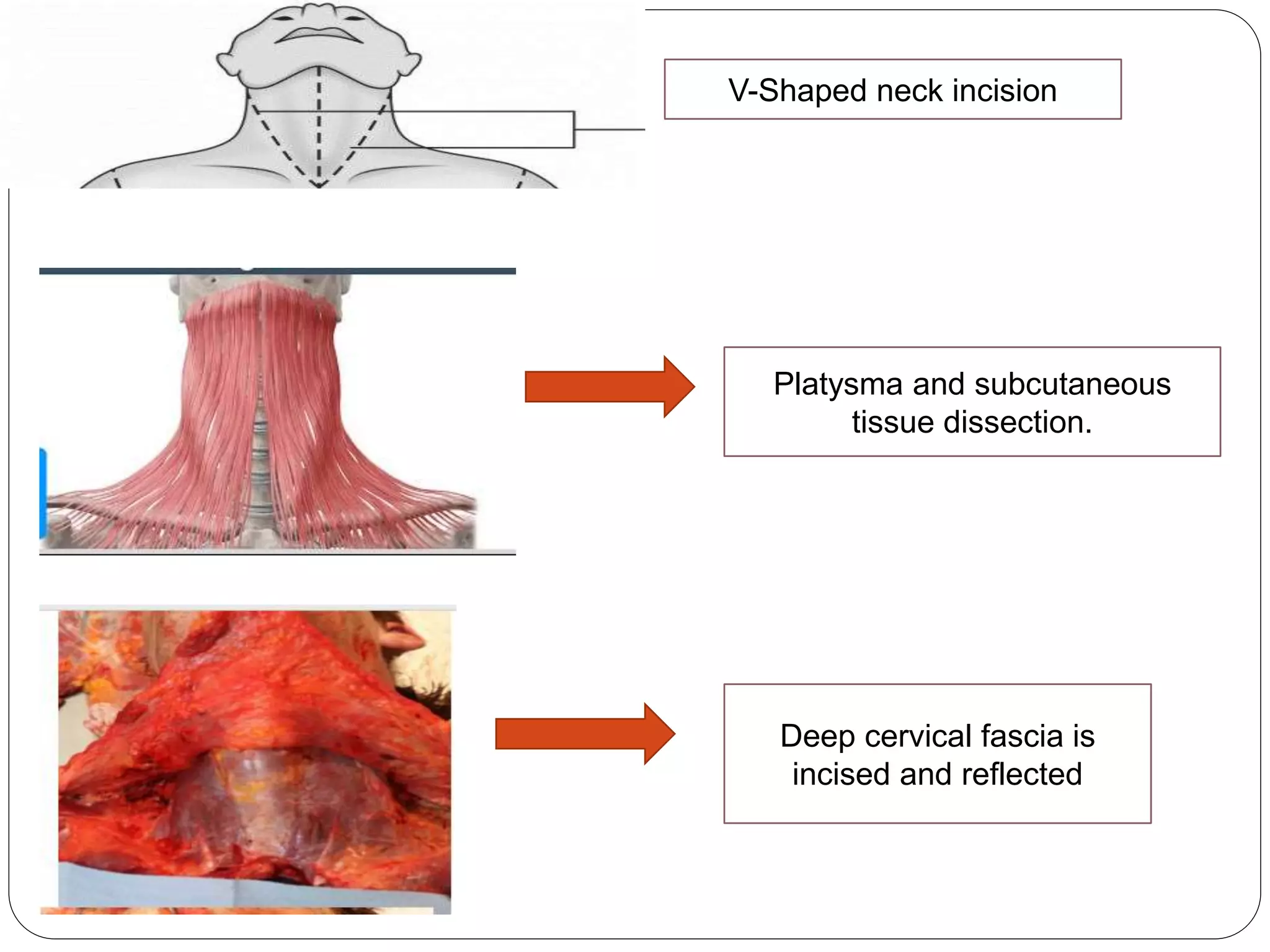 anatomy of neck and its medicolegal importance | PPTX