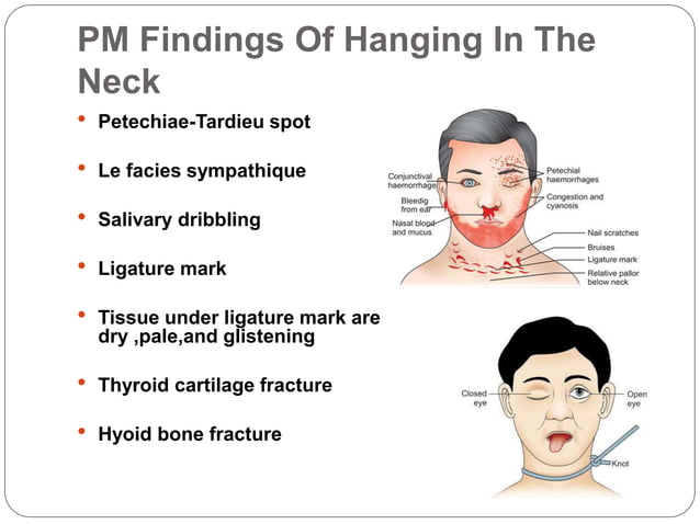 anatomy of neck and its medicolegal importance | PPTX