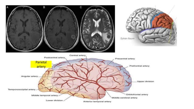distribution of body schema and spatial relationship | PPTX | Brain and ...