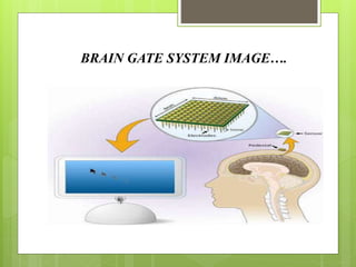 BRAIN GATE SYSTEM | PPT