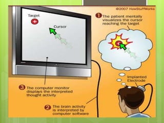 BRAIN GATE SYSTEM | PPT