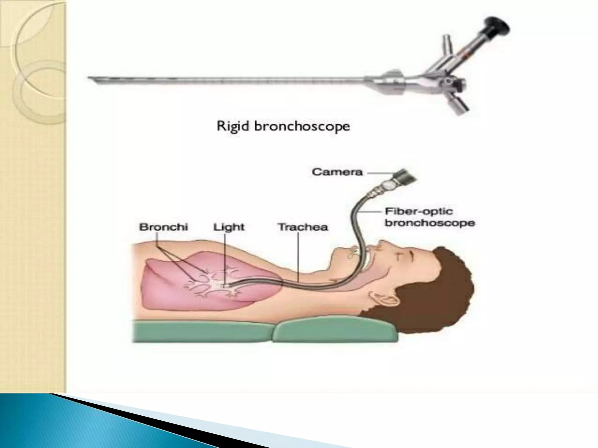 BRONCHOSCOPY | PPTX