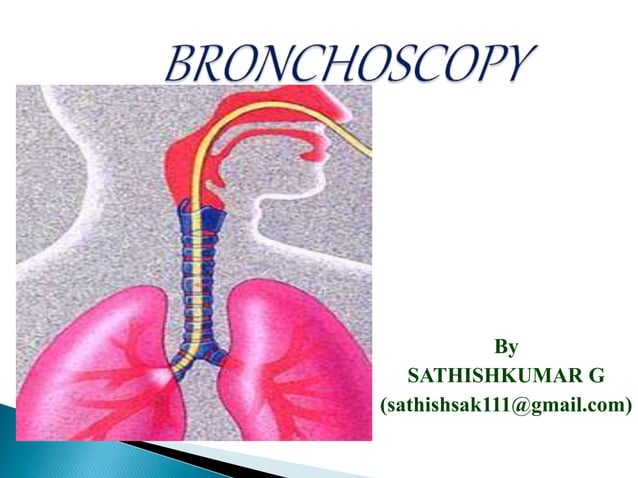 BRONCHOSCOPY | PPTX